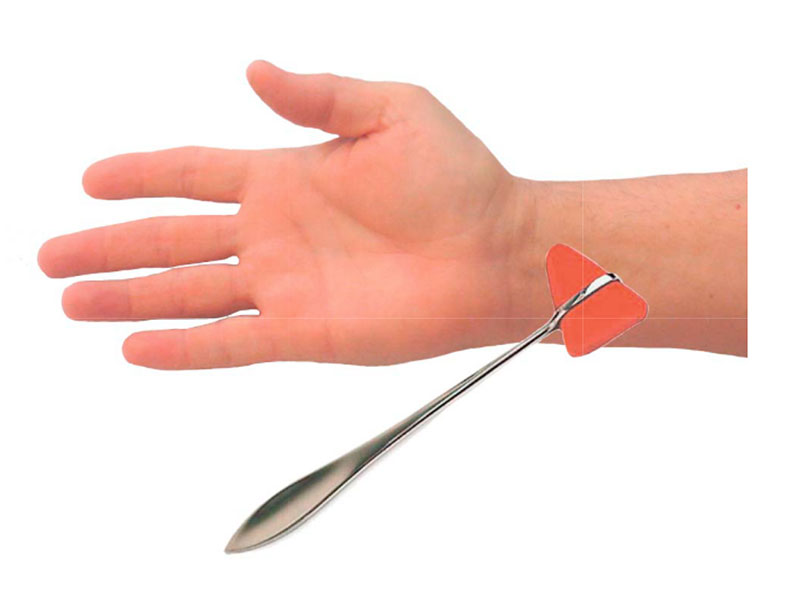 Sindrome del Tunnel Carpale: diagnosi, cause e cure - Fisioterapia Latina