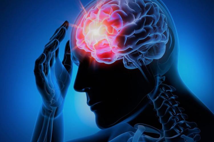 Emicrania e Cefalee. Come può aiutarti il Neurologo - Poliambulatorio ...