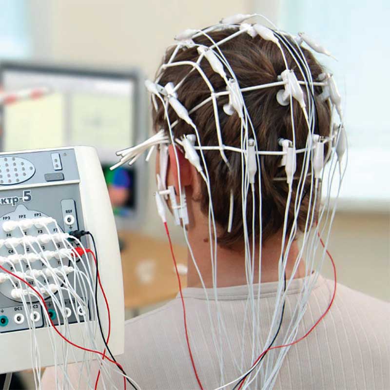 Prenotazione Elettroencefalogramma (EEG) Latina - Poliambulatorio LT